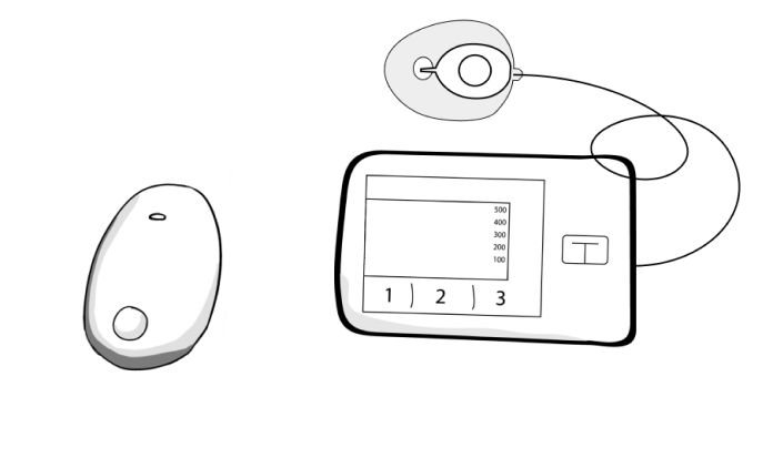Eversense And Tandem Vs Omnipod 5 Smart System Unbias Comparison 1307